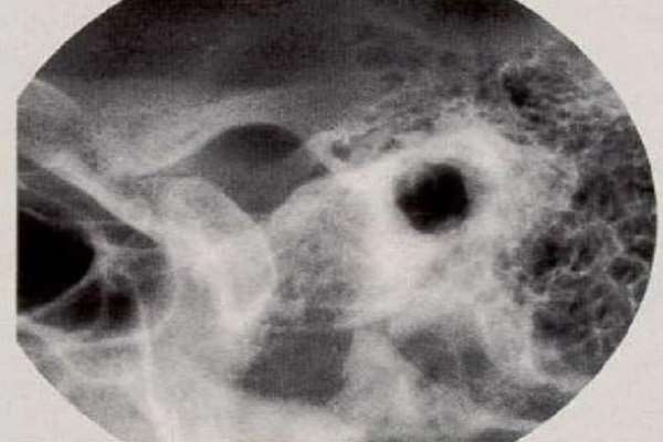 CHỤP X QUANG SCHULLER KTS - 179.000 đ | medim.vn